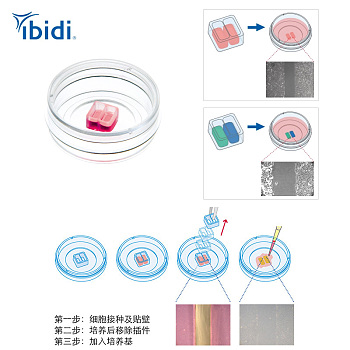 ibidi 划痕实验/伤口愈合2孔插件,25 Culture-Inserts 2 Well for self-insertion 培养皿 24孔板 多孔板 多腔室载玻片 预置插件培养皿 ...